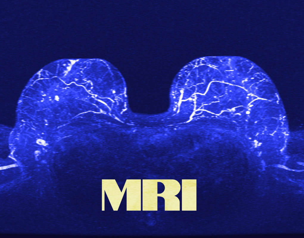 Breast MRI, prof. Uwe Fischer course | Mammologicum